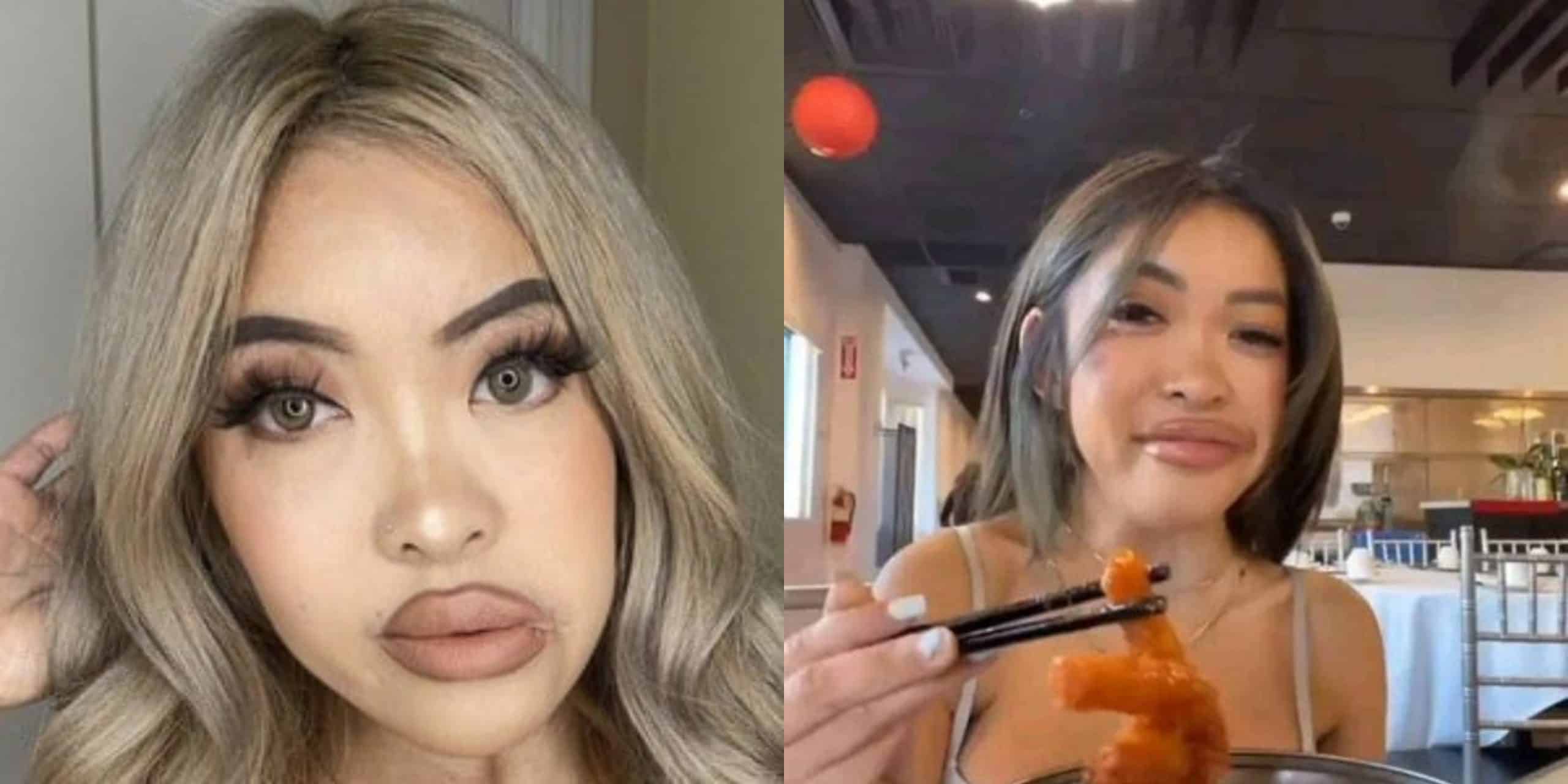 Influencer na si Jennifer Ngo na nilalait ang itsura dahil sa hindi ...