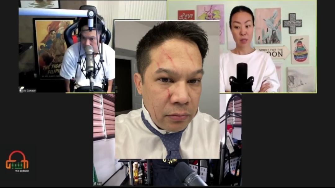 Mo Twister, ipinakita ang mga kalmot sa mukha sa gitna ng hiwalayan ...