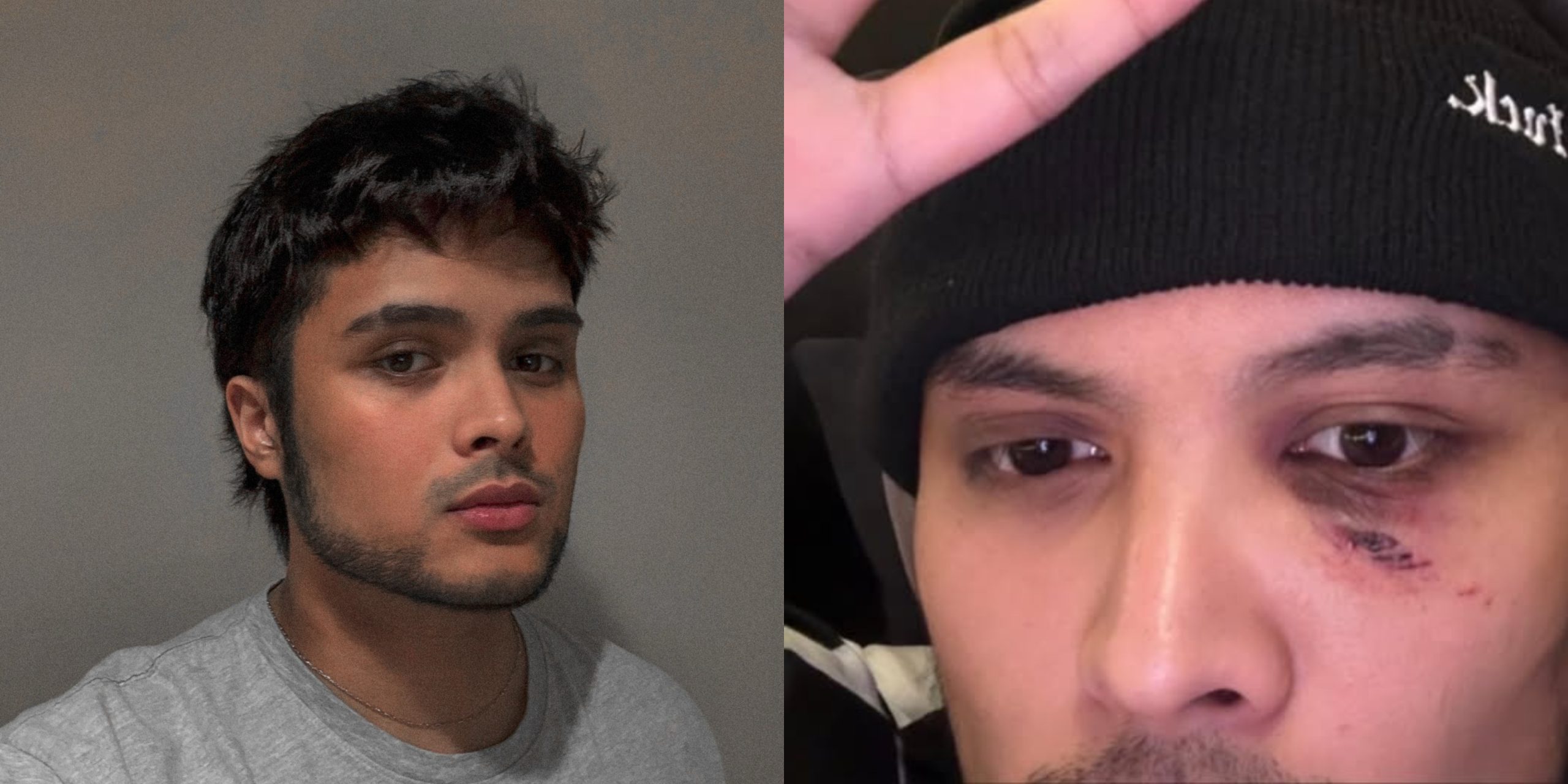 Julian Ejercito, ibinahagi ang buong kwento ng nangyaring pangunguyog ...